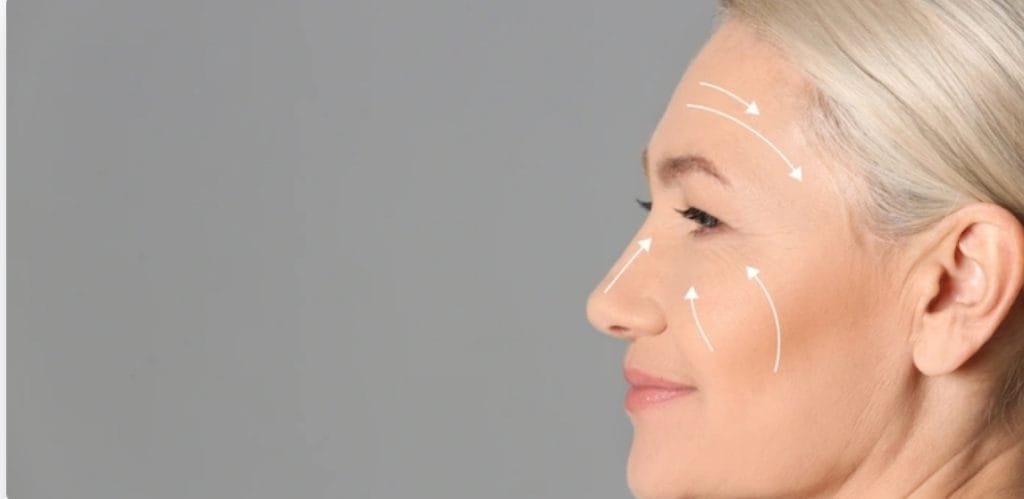 A Comprehensive Guide About Facelift in Turkey - Lerra Clinic - The ...